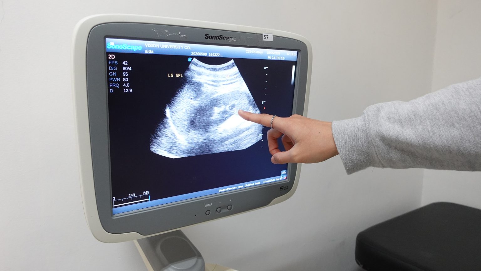 Diploma in Medical Imaging at Vision University College: A Pathway to a ...